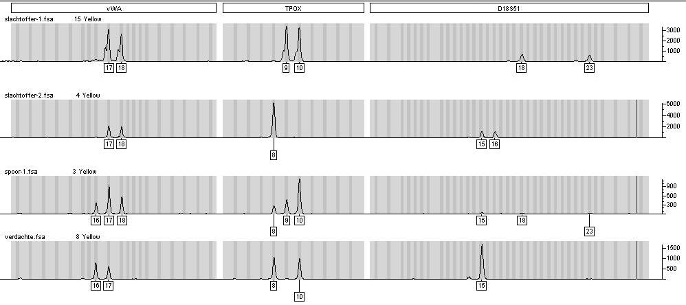 Achtergrond van het DNA-onderzoek_hoe wordt DNA onderzocht?